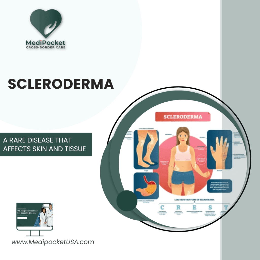 Scleroderma: Affecting Skin and Tissue - Learn More