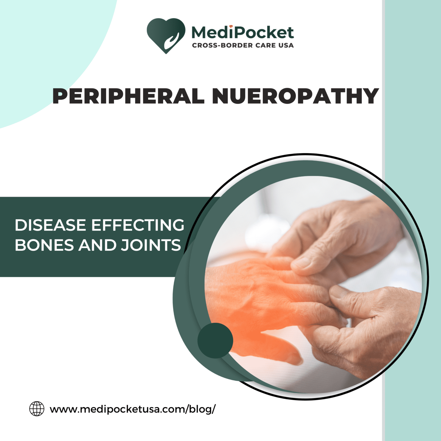 Peripheral Neuropathy: Causes and Management