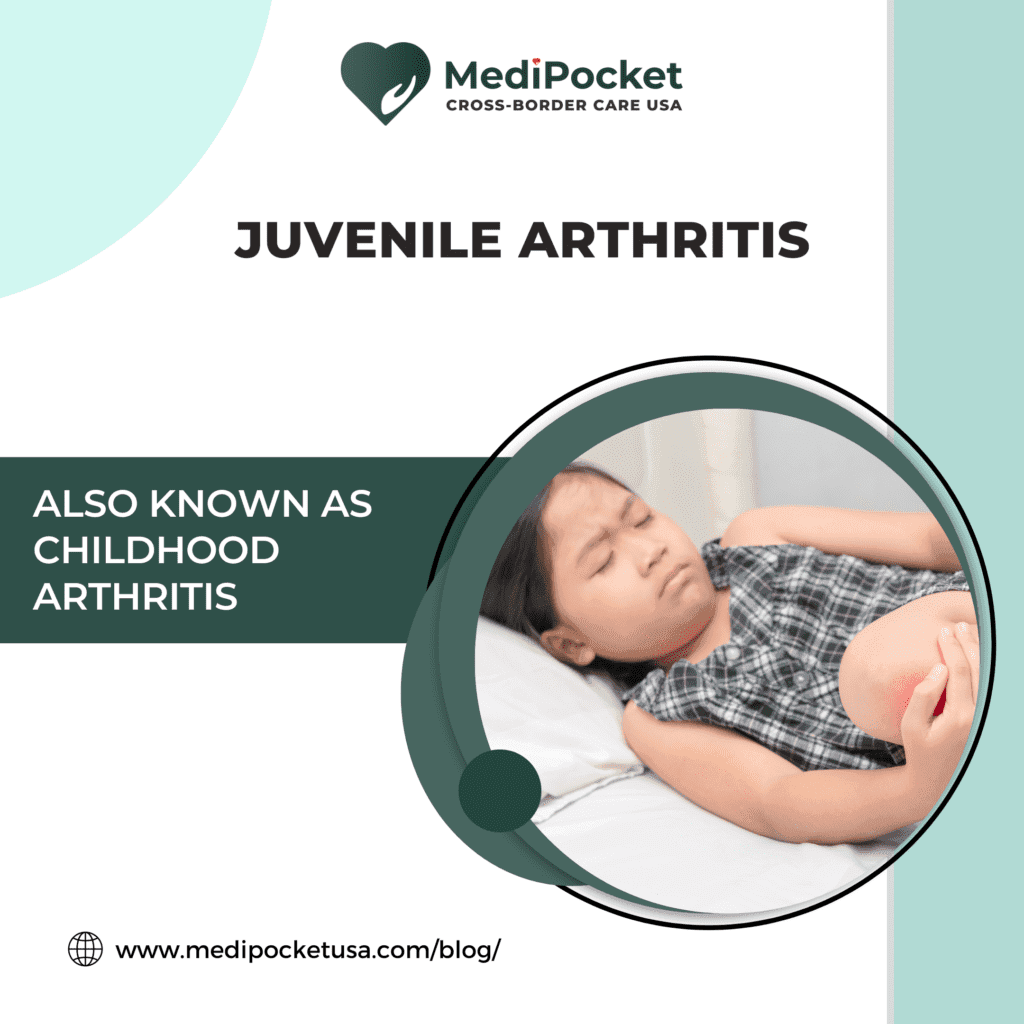 Juvenile Arthritis: Understanding Childhood Arthritis