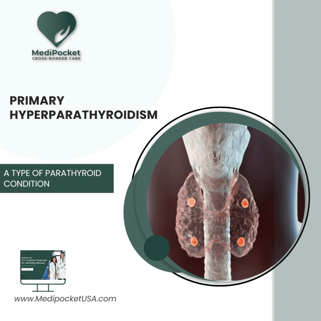 Primary Hyperparathyroidism: Causes and Treatments