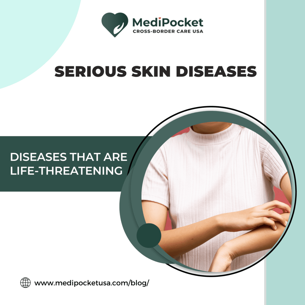 Serious Skin Diseases: Talk to a US Dermatologist Now